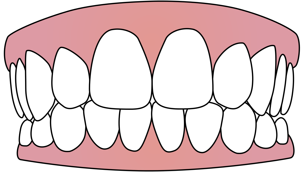 Dentures Drawing, Tooth Images Download PNG Transparent Background ...